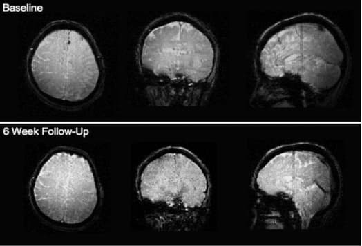 Japan's "Rising Sun" Brain Enhancer