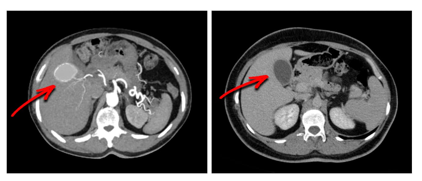 This BONEHEADED medical error almost KILLED me.